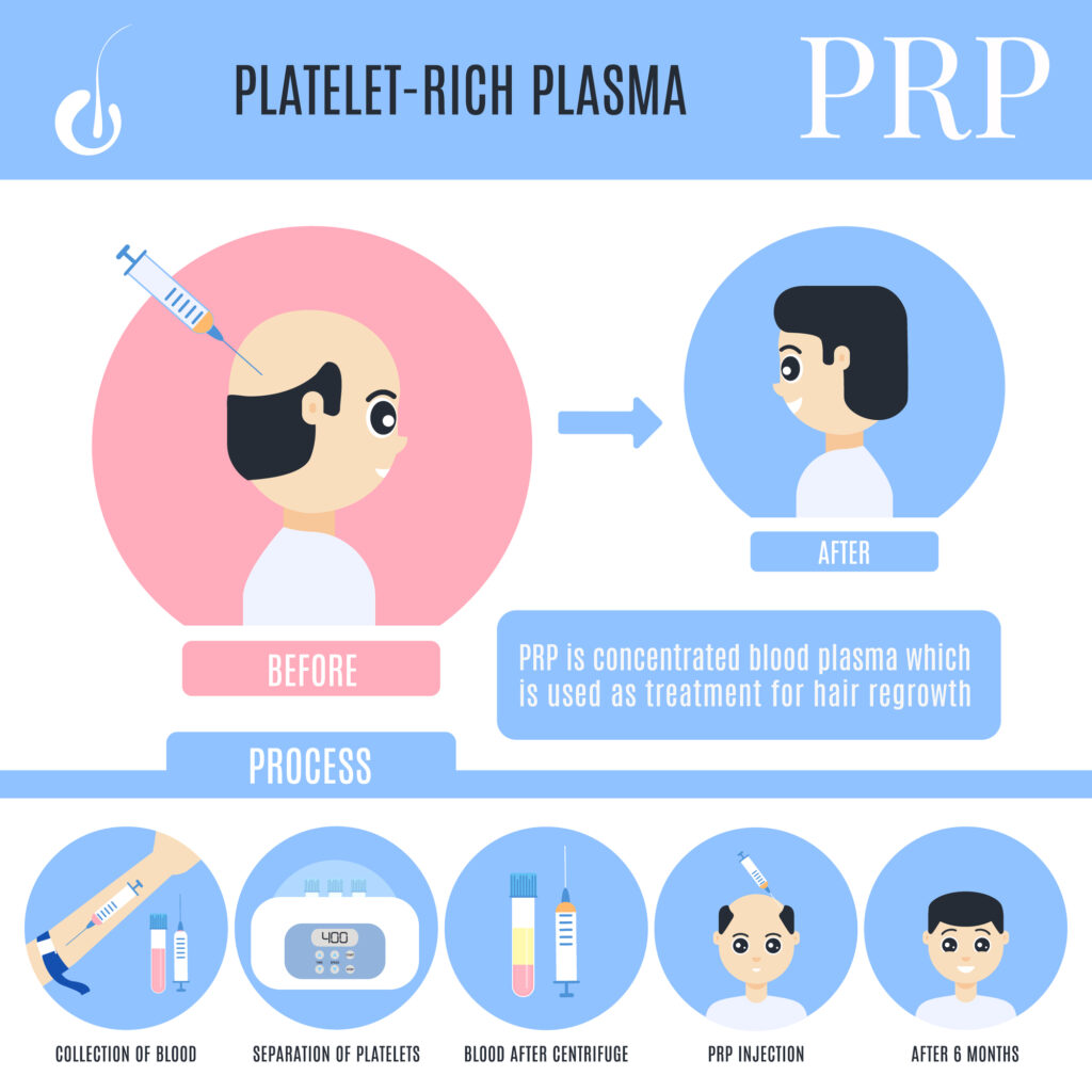 What Is Deposition In Science Hair Restoration Physicians